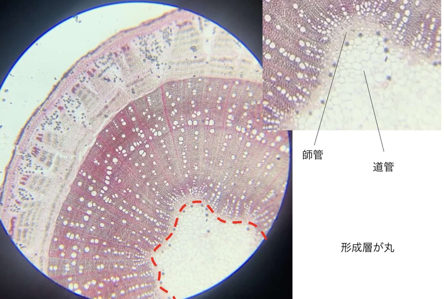Preparing a rose of Sharon stem with a slide kit is easy and the results are amazing! Don’t just ...